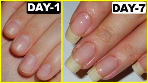 How To Grow Your Nails Fast In A Week