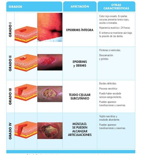 EstadÍos Úlceras Por PresiÓn