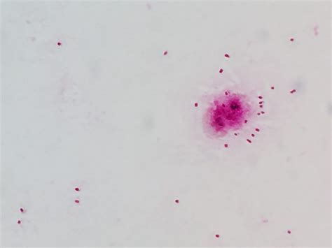 Citrobacter Freundii〔シトロバクター〕 グラム染色 Gram Stain
