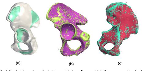 figure 1 from using of statistical shape models for pelvis