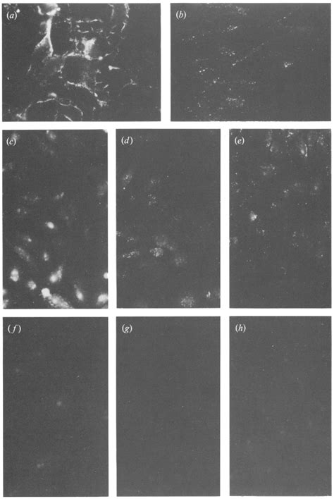 Detection Of Membrane Antigens With Mab N2 Membrane Immunofluorescence Download Scientific
