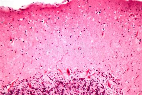 Human Motor Cortex Photomicrograph Showing Pyramidal Neurons In Cortical Layers Responsible For