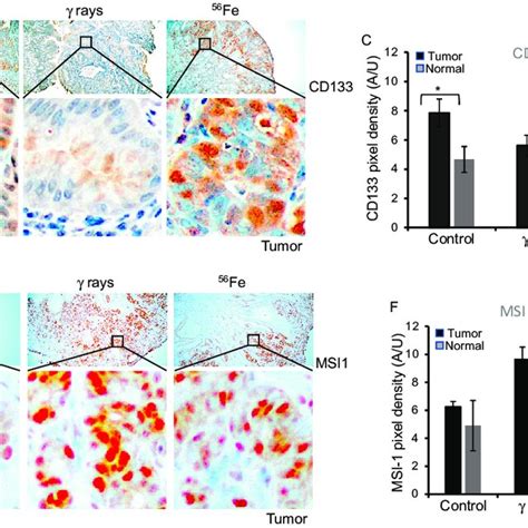 Response Of Dclk1 After Low And High Let Irradiation In Intestinal