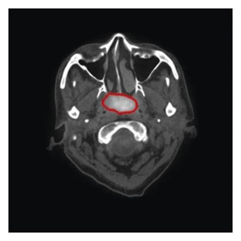 An Example Of The Feature Maps In The Fourth Upsampling Block A A Download Scientific