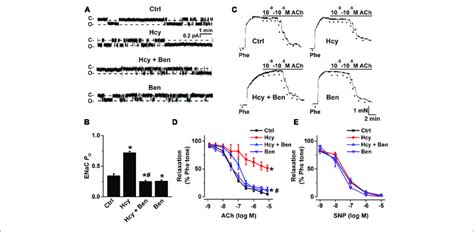 Benzamil Attenuates Exogenous Hcy Induced Increase In Endothelial