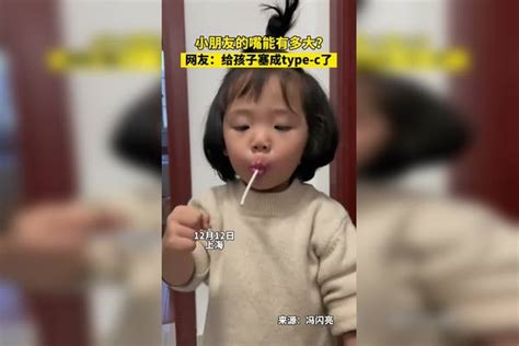 小朋友的嘴能有多大？网友：给孩子塞成type C了