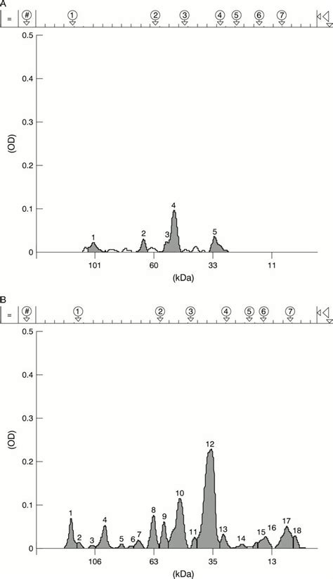 Male Sex Predominance In Chlamydia Trachomatis Sexually Acquired Reactive Arthritis Are Women
