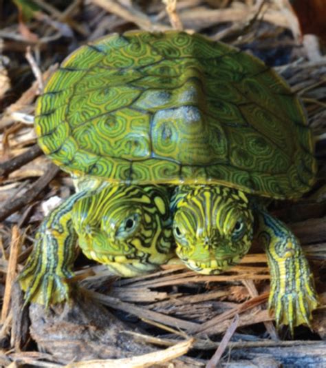 Dicephalus Dipus Dibrachius Conjoined Twins Through The Ages Pmc