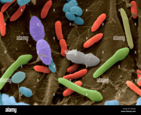 Scanning Electron Micrograph Sem Mixed Bacteria From Human Faeces
