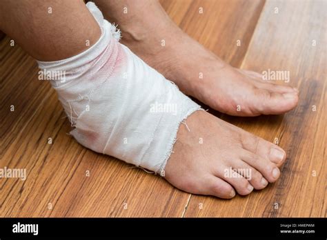 Lady With A Wrapped Foot On Floor Stock Photo Alamy