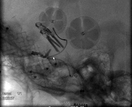 Image Radiopaedia Org