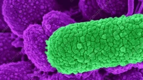 Oral Bacteria Sem Stock Video Clip K0056854 Science Photo Library