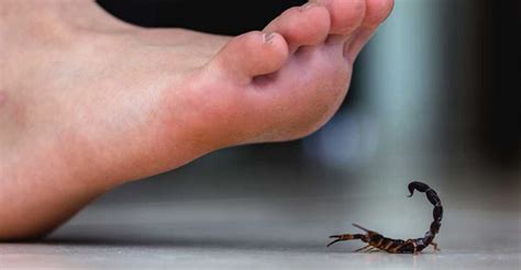 Water Scorpion Bite