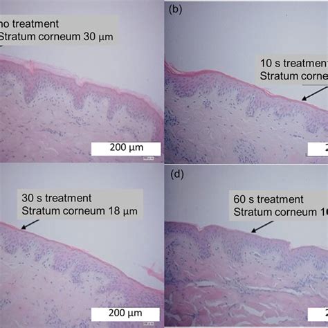 Histological Cross Sections Of A Nontreated Skin Sample B 10 S