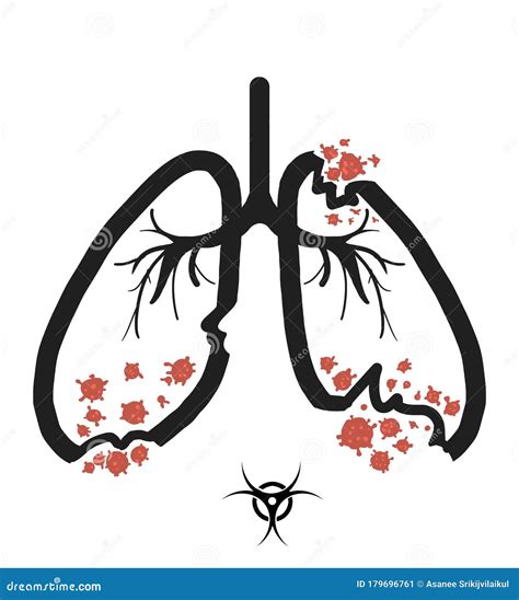 A Danger Of Viral Pneumonia Infection Stock Illustration