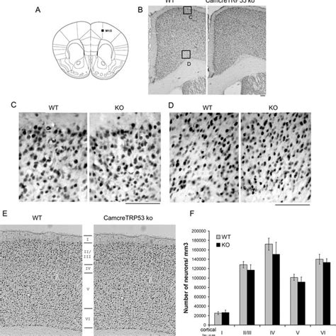 A Brain Schematic Showing The Motor Cortex Area Examined In Images B Download Scientific