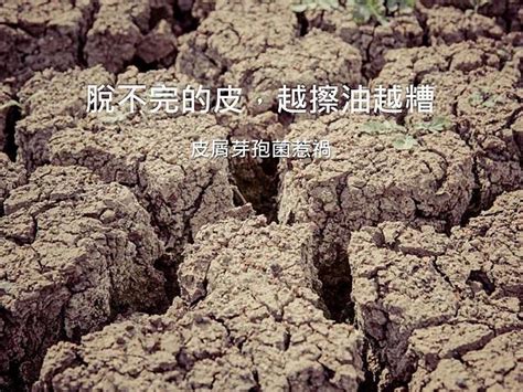 脫不完的皮，越擦油越糟 皮屑芽孢菌惹禍 潮流、美妝、消費 創造個人化風格的女性社群 Pixstyleme