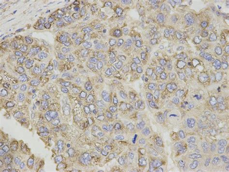 Cpt1a Antibody Sab Signalway Antibody