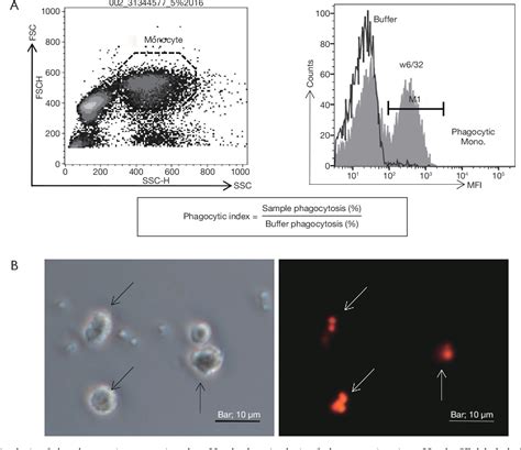 Figure From Human Leukocyte Antigen Antibody Detection Technologies In Platelet Transfusion