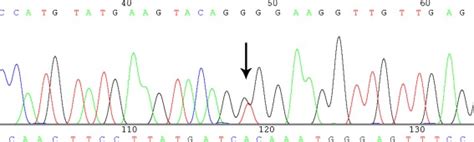 Mutational Analysis Of The KIT And PDGFRA Genes Has Become An Important