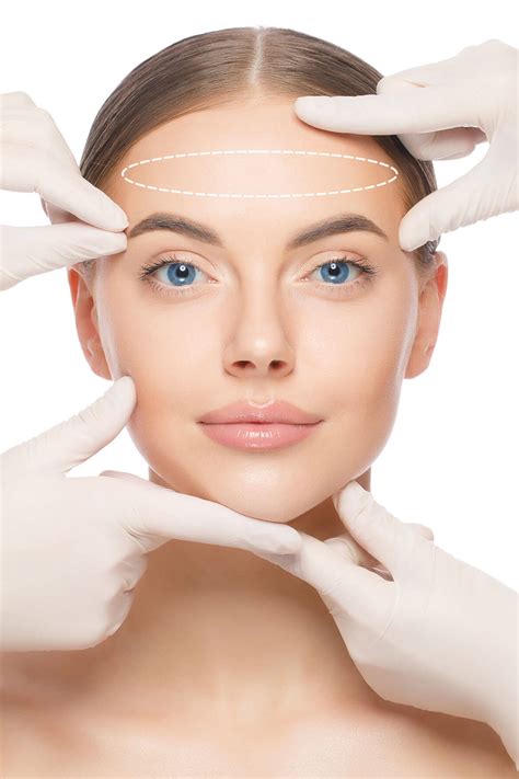 Surgically Forehead Lift Avitia Clinic