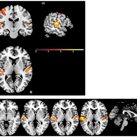 Statistical Parametric Map Of Active Regions Using “stimulus Vs Download Scientific Diagram
