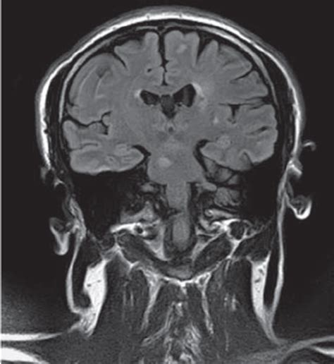 Diffusion Weighted Imaging Show Download Scientific Diagram