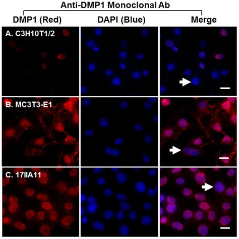 Nuclear Localization Of Endogenous Dmp1 Proteins Immunofluorescent