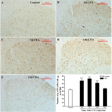 Phosphor Atf 2 Ir Cells Expression In The Ipsilateral Spinal Cord