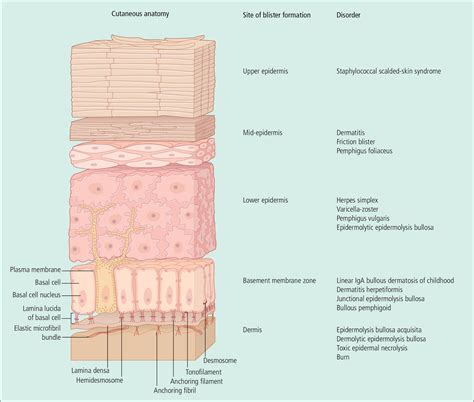 Vesiculopustular Eruptions Clinical Tree