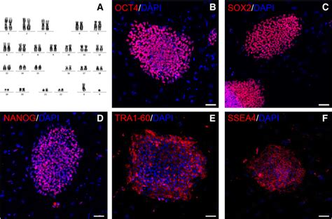 Characterization Of Human Ips Cells A A Karyotype 46 Xy Of An