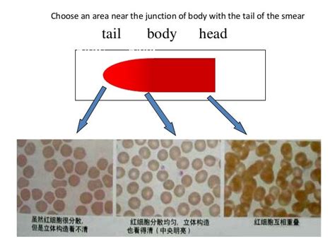 Differential Leukocyte Count