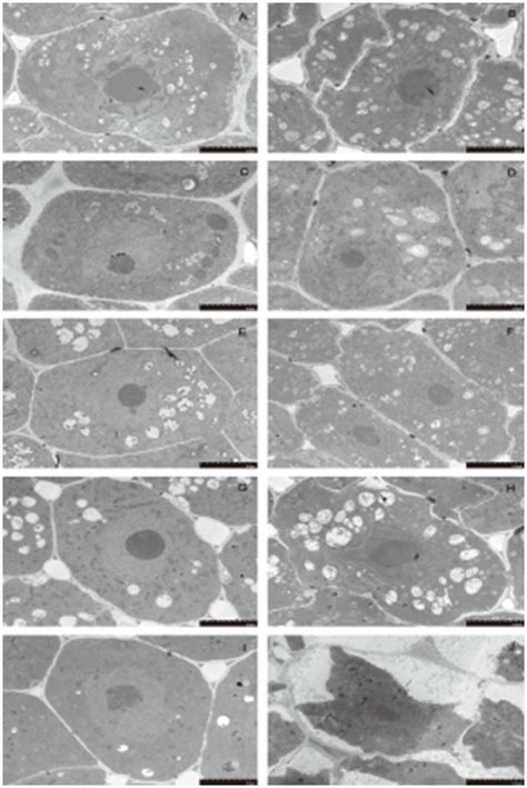 Subcellular Structure Of Meristematic Cells From Mung Bean Hypocotyls