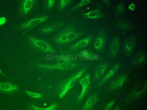 Cytoskeleton Showed By Gfp Stock Image Image Of Exposure 24414283