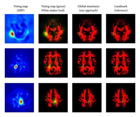Differently Weighted Linear Combinations Of The Feature Images Lead To