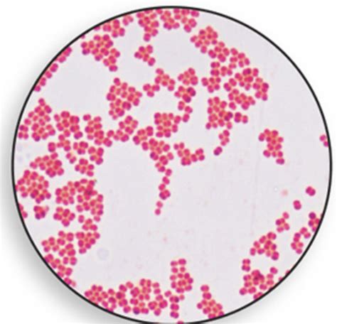 Microbiology Lecture Exam 1 Flashcards Quizlet