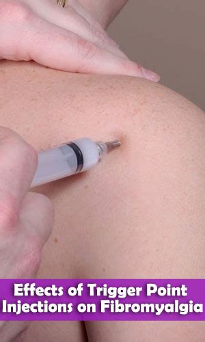 Effects Of Trigger Point Injections On Fibromyalgia Redorbit