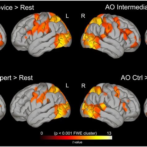 Brain Activations During The Experimental And Control Conditions The Download Scientific
