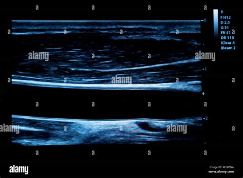 Moniteur Echographie Banque De Photographies Et Dimages à Haute