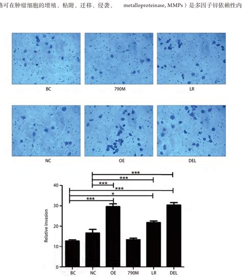 Effects Of Egfr Over Expression And Mutations On Cell Invasion In H1299 Download Scientific