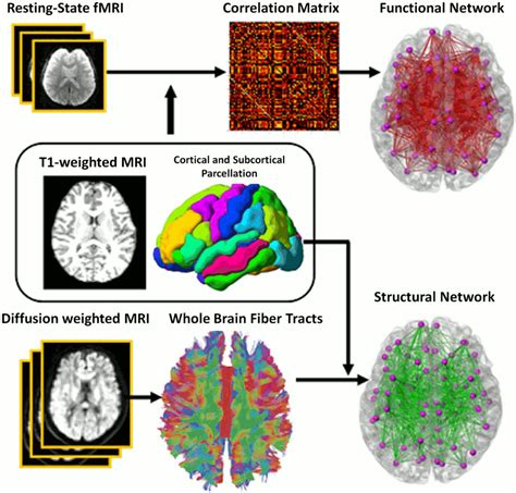 A Schematic Diagram Of The Functional And Structural Network Analysis Download Scientific Diagram