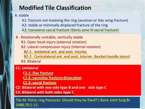 Pelvic Fracture Classification