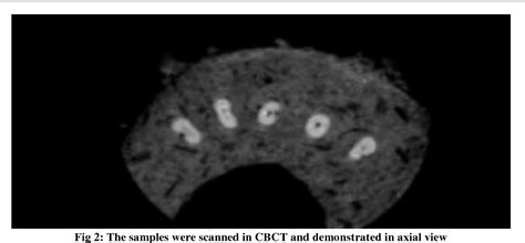 Figure 2 From The Effect Of Two Different Voxel Sizes On The Diagnosis
