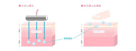 イオン導入 美容皮膚科アルファクリニック銀座・新宿・池袋【医療脱毛・hifu・水光注射】etc