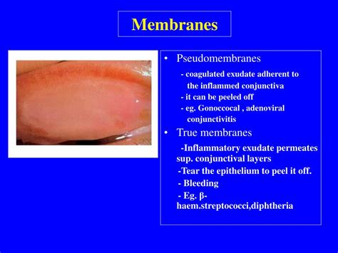 Ppt Conjunctiva Powerpoint Presentation Free Download Id982962