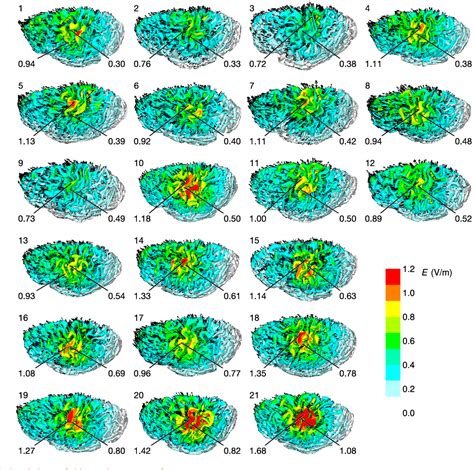 Figure 3 From Small Effects Of Electric Field On Motor Cortical Excitability Following Anodal