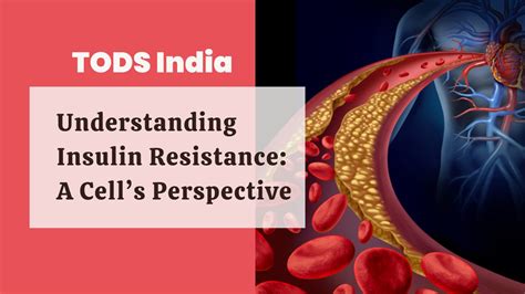 Understanding Insulin Resistance A Cells Perspective