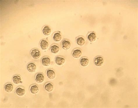Day 4 Embryos Copact Morulla Finally I Can Say Injected By Me😅🤍