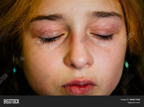 Little Sad Girl After Image And Photo Free Trial Bigstock