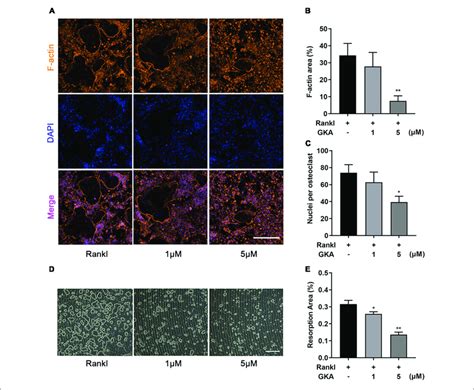 Gka Attenuated Rankl Induced Osteoclast Fusion And Bone Resorption In